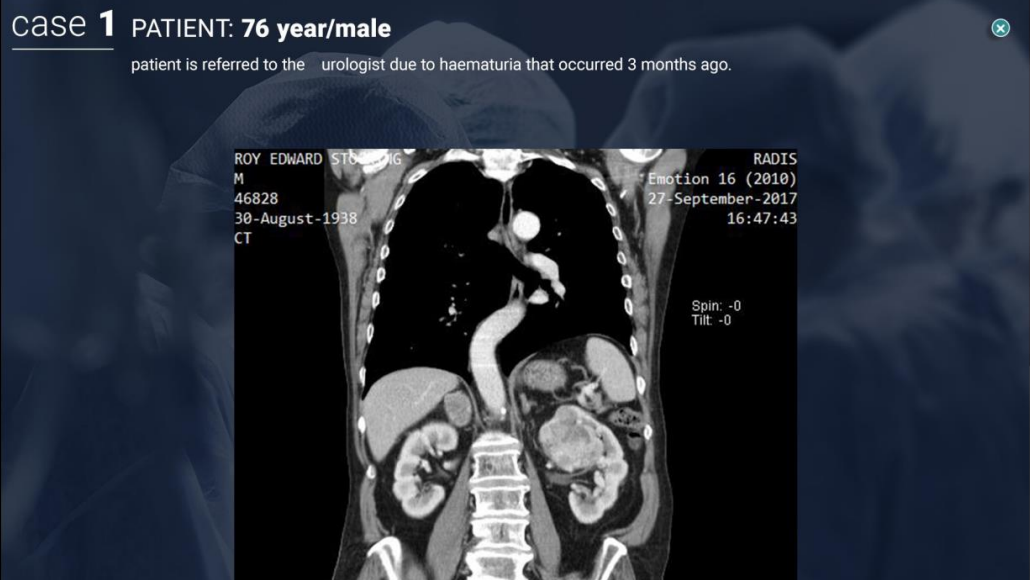 Drawing lessons from the EBU’s first virtual exam - Uroweb