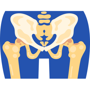 Bladder pain syndrome - Uroweb - Patient Information