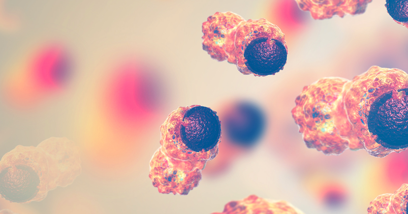 Kidney Cancer - Uroweb