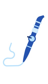Ureteroscopy (URS) for kidney stones - Patient Information