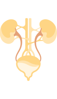 Duplex kidney - Patient Information