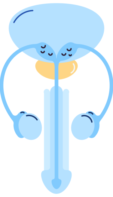 Prostate cancer stage 3 - Uroweb - Patient Information