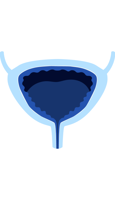 Overactive Bladder - Patients